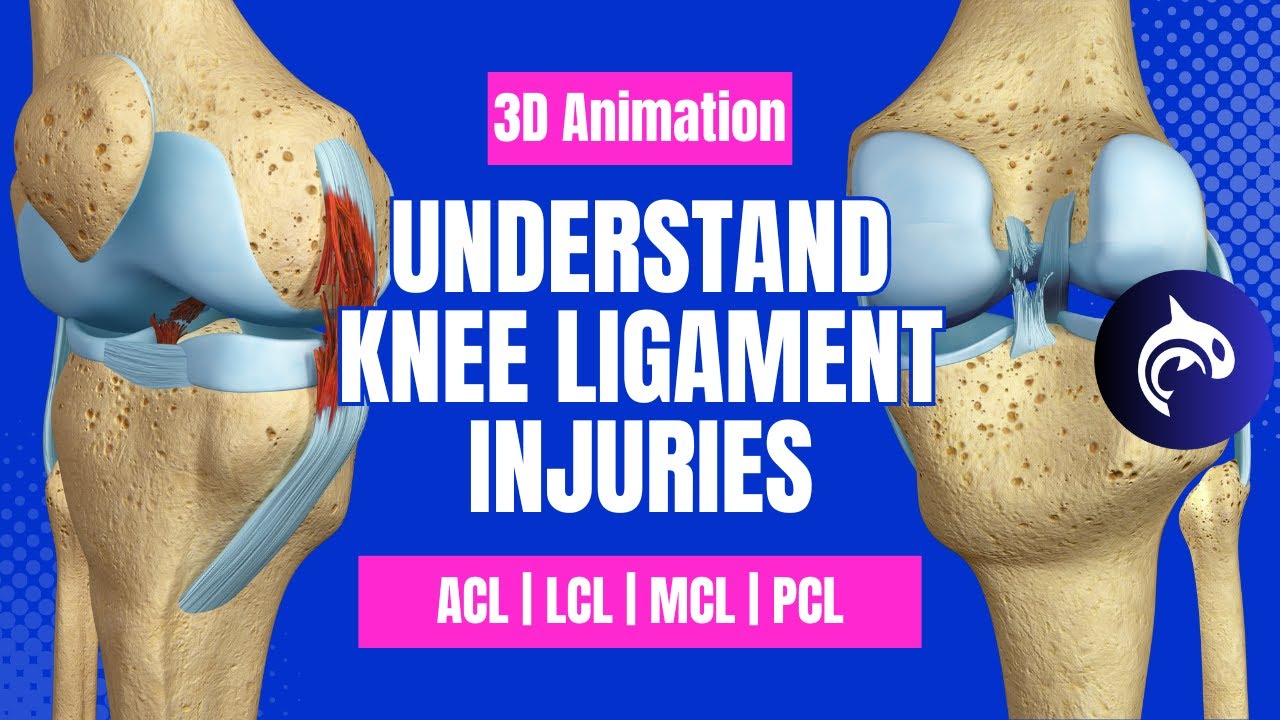 ACL Tear vs MCL Tear Differences & Treatment | SanteNews