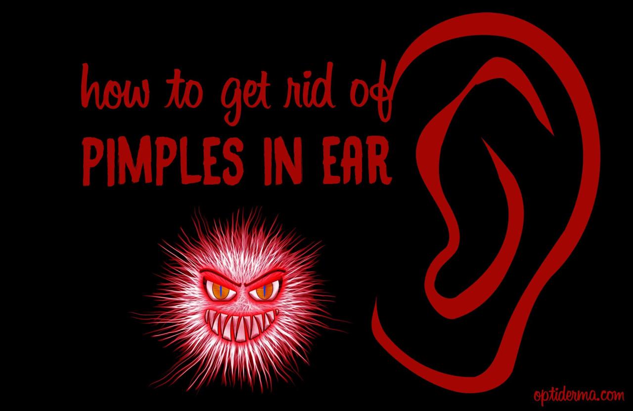 Ear Pimples Causes & How to Get Rid of Them | SanteNews